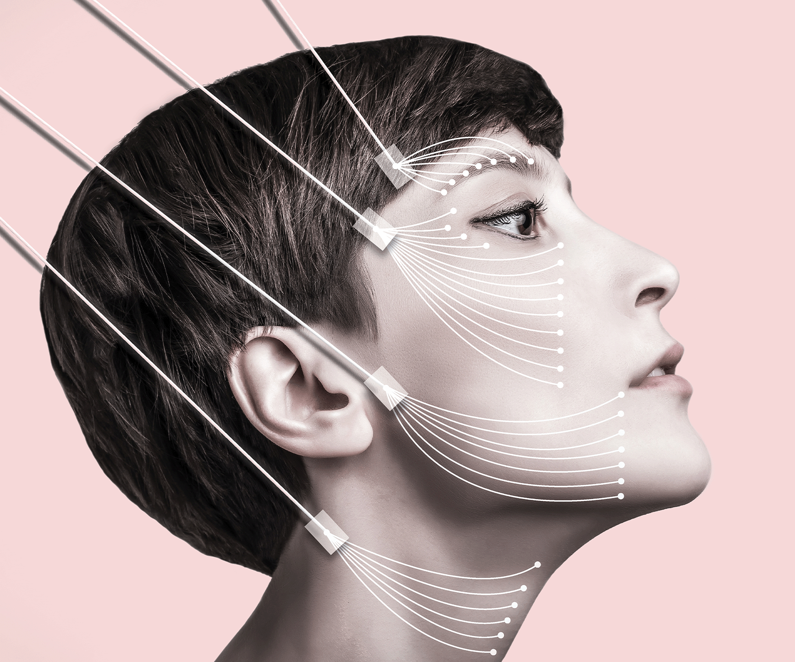 Minimal Downtime, Maximum Results - PDO Thread Lifting - Five Star Clinics